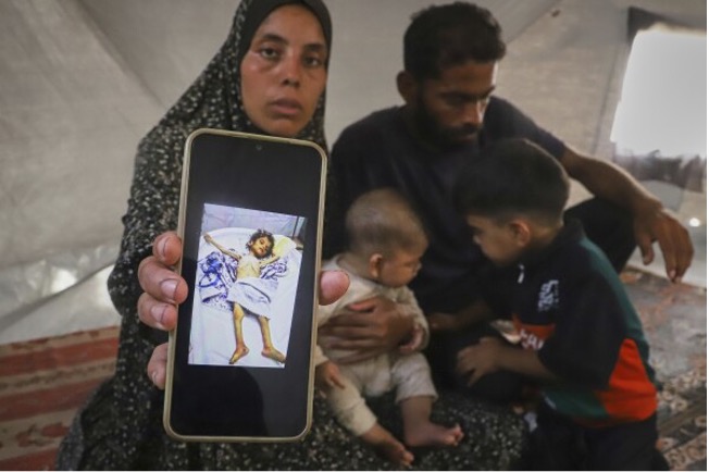 Gaza children are skin-and-bones, but Netanyahu says no one’s hungry ...